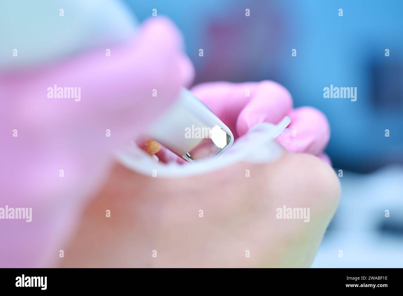 Dentist scaning patient's teeth with dental 3d scanner and screen with ...