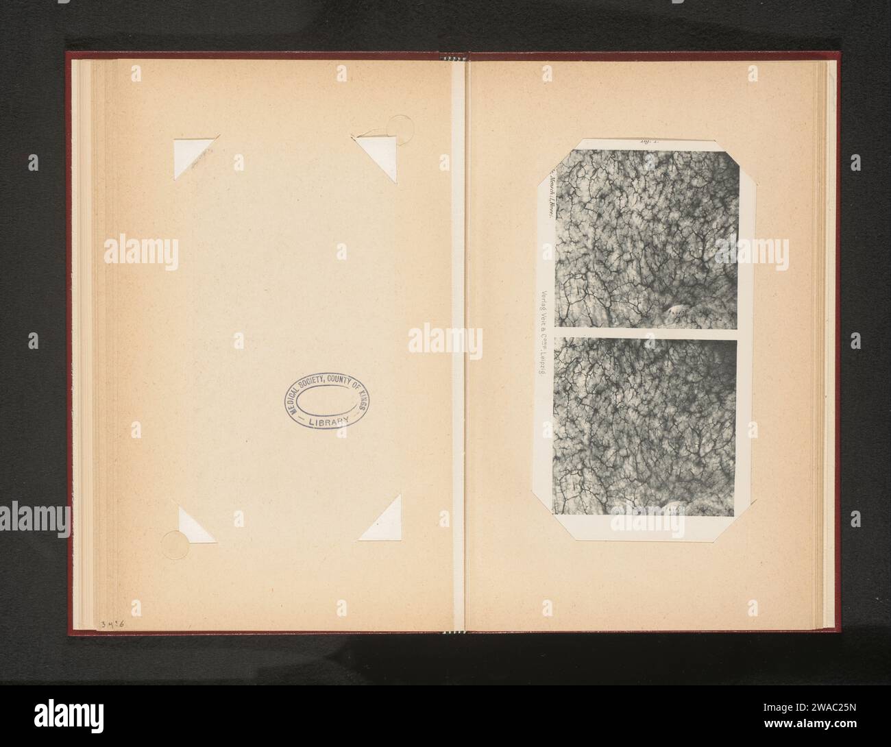 Microscope intake of human skin of a foot sole, E. Schleicher, c. 1885 ...