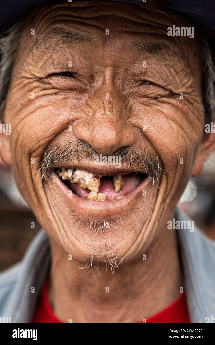 Toothless people hi-res stock photography and images - Alamy