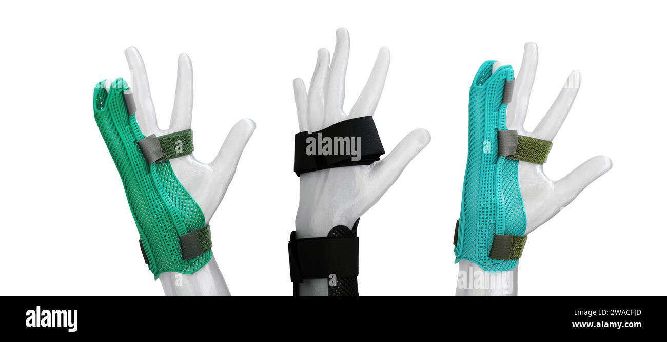 Close up of hand in comfortable adjustable immobilizer. Thermoformable ...
