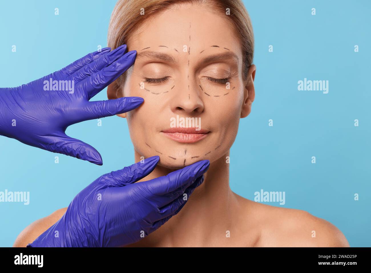 Doctor checking patient's face before cosmetic surgery operation on ...