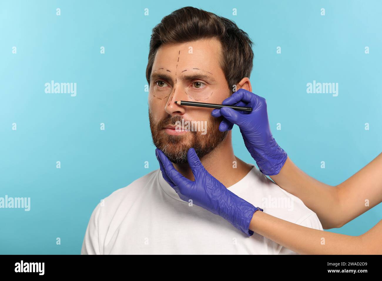 Doctor with pencil preparing patient for cosmetic surgery operation on ...