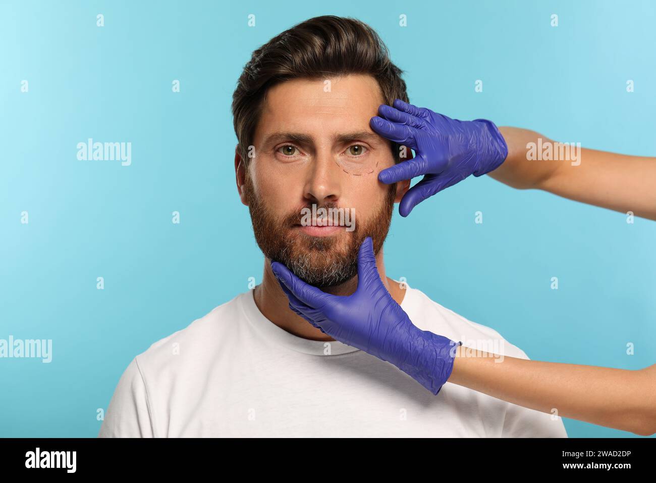Doctor checking patient's face before cosmetic surgery operation on ...
