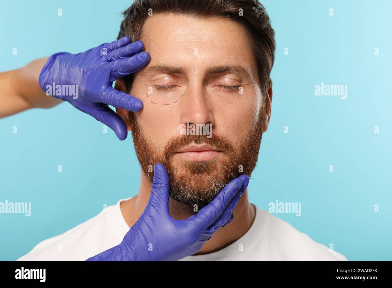 Doctor checking patient's face before cosmetic surgery operation on ...