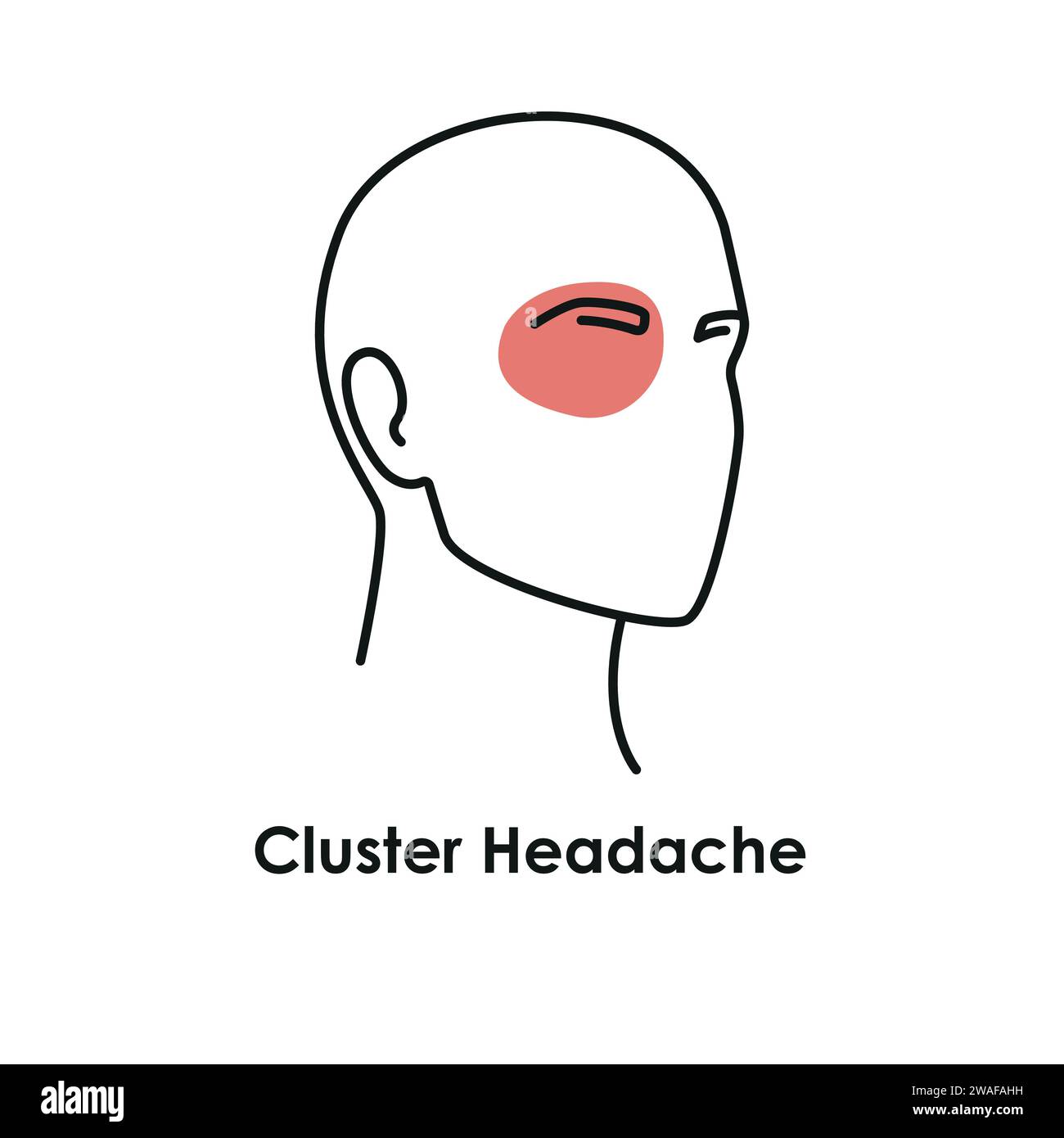 Cluster headache color icon. Vector isolated illustration. Migraine ...