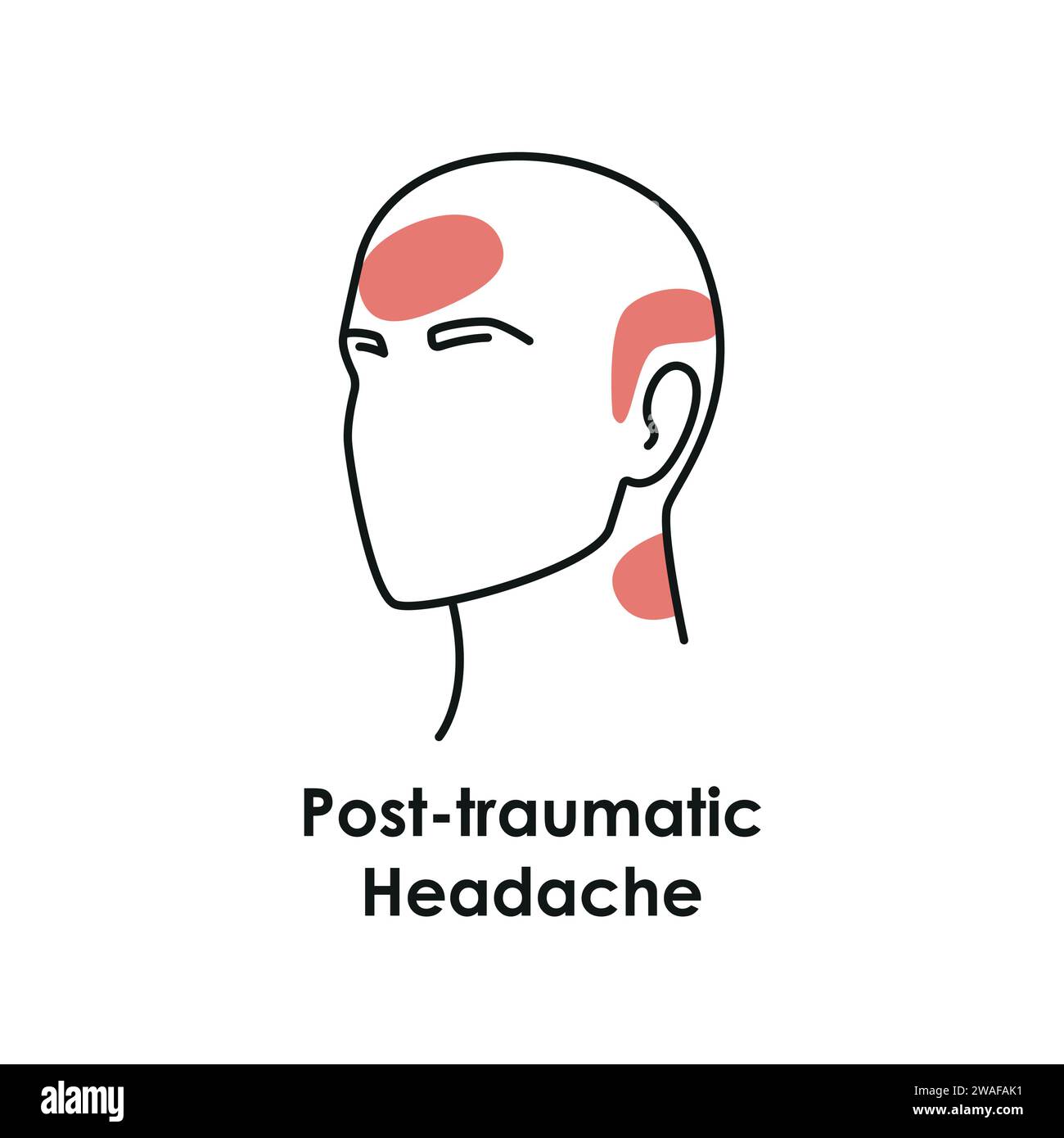 Post-traumatic Headache color icon. Vector isolated illustration ...
