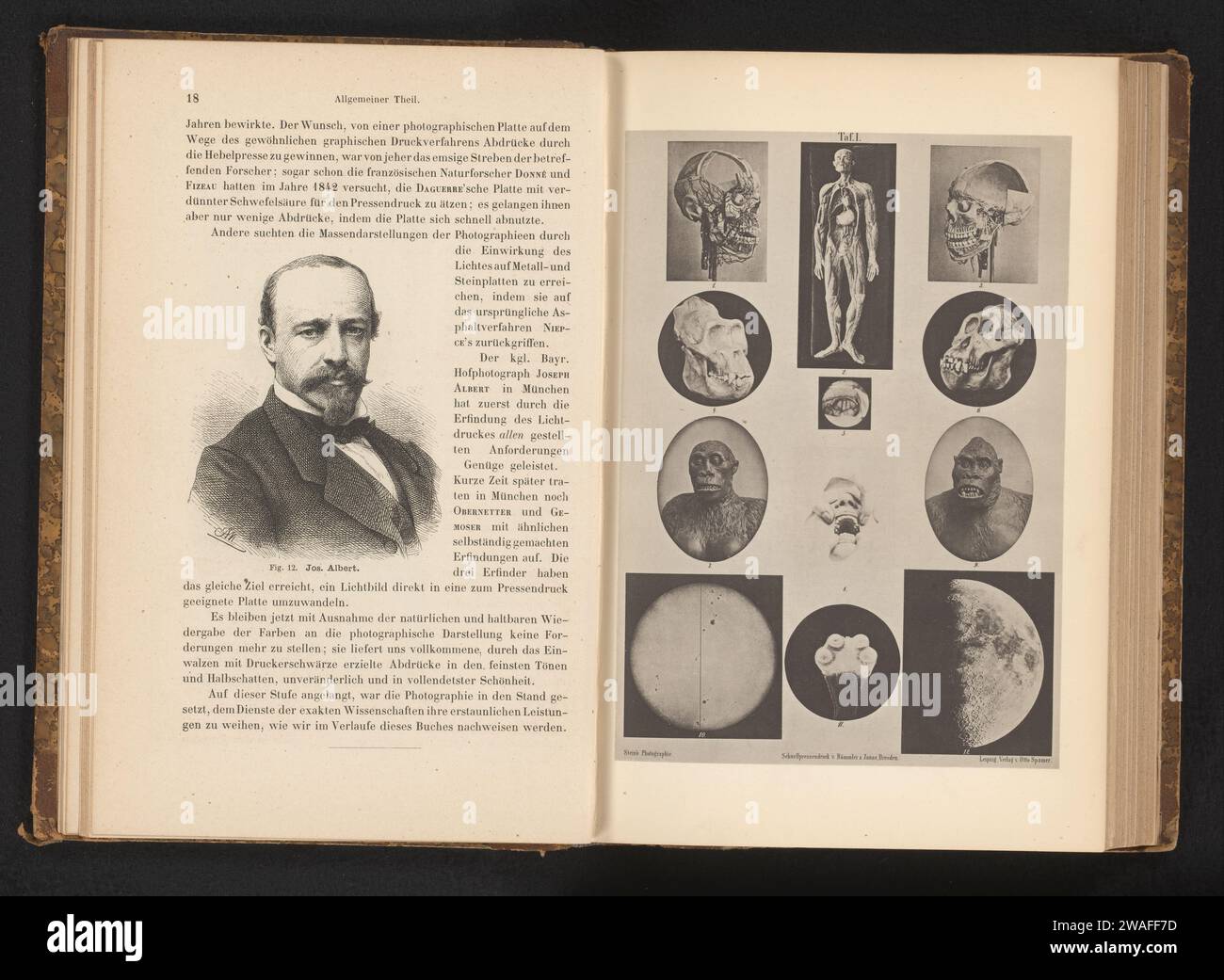 Anatomical overview hi-res stock photography and images - Alamy