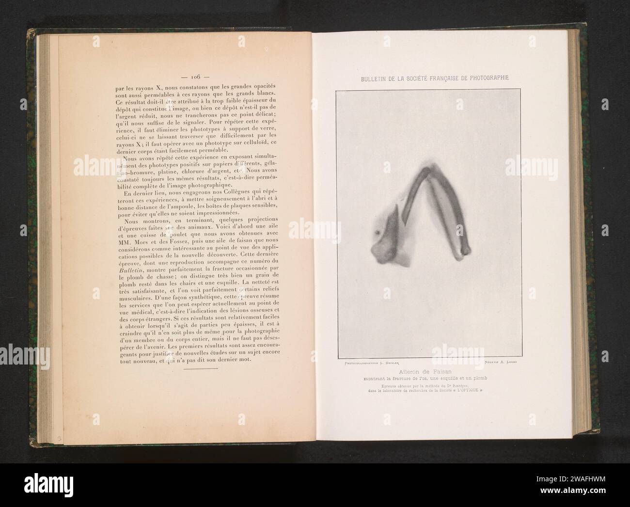 X -ray of a bone from a pheasant, Albert Londe, c. 1886 - in or before ...