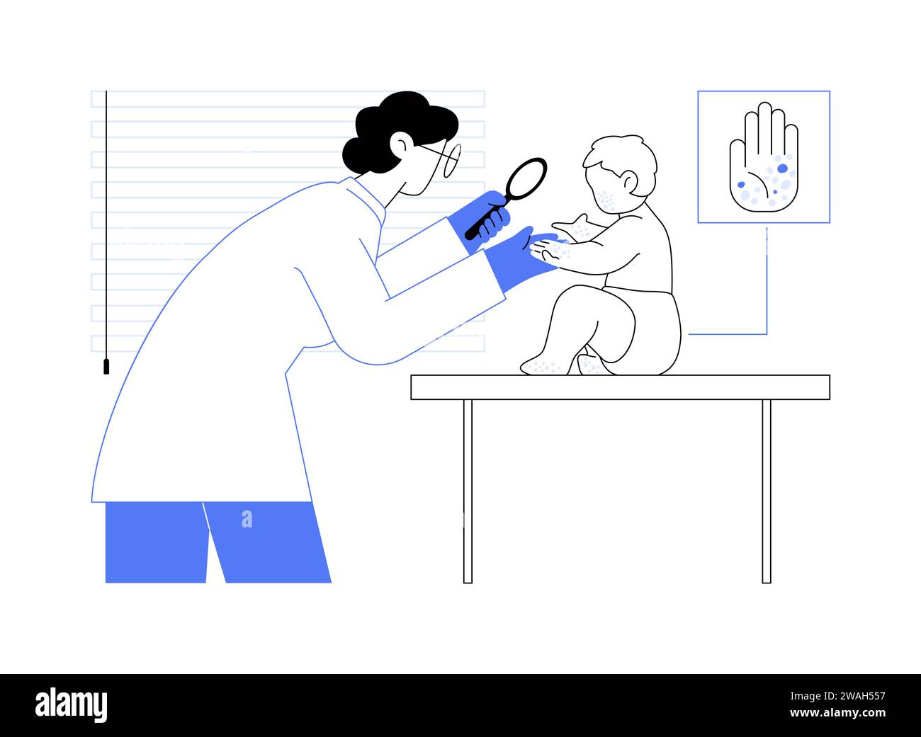 Hand foot and mouth disease abstract concept vector illustration Stock ...