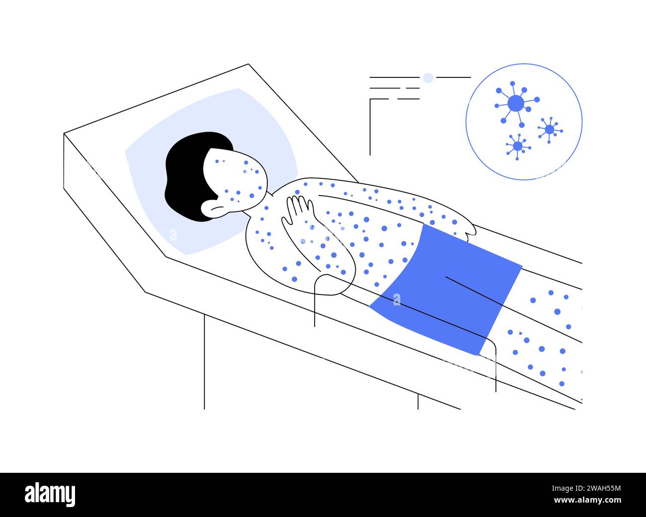 Chickenpox abstract concept vector illustration Stock Vector Image ...