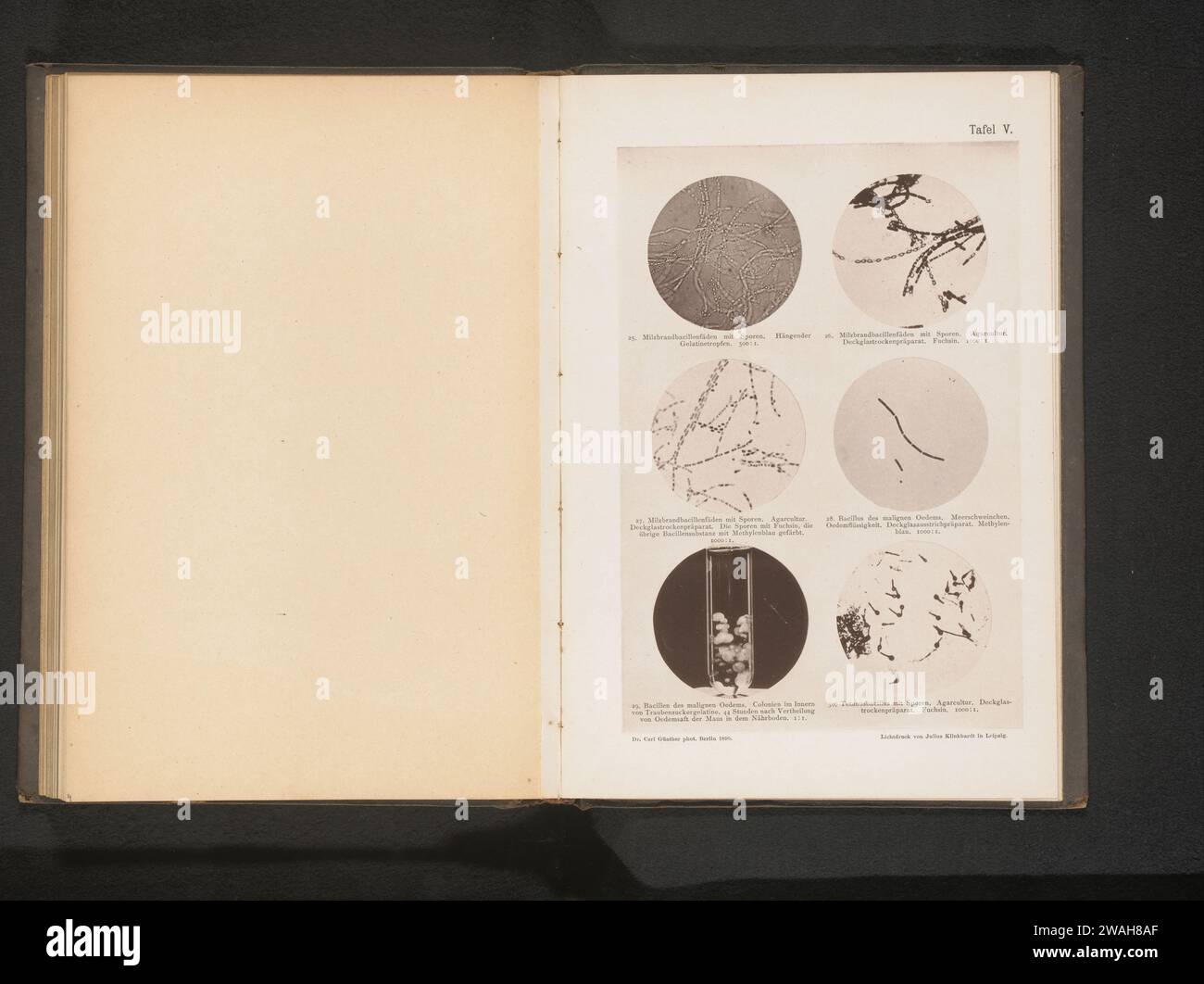 Six microscope recordings of bacteria, including the Siltvuurbacterie ...