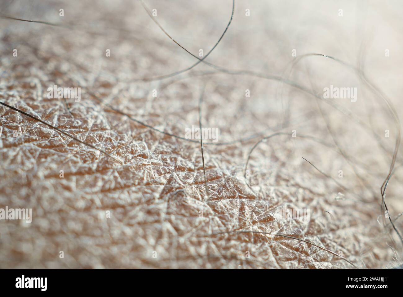 Closeup view of dry human skin Stock Photo - Alamy