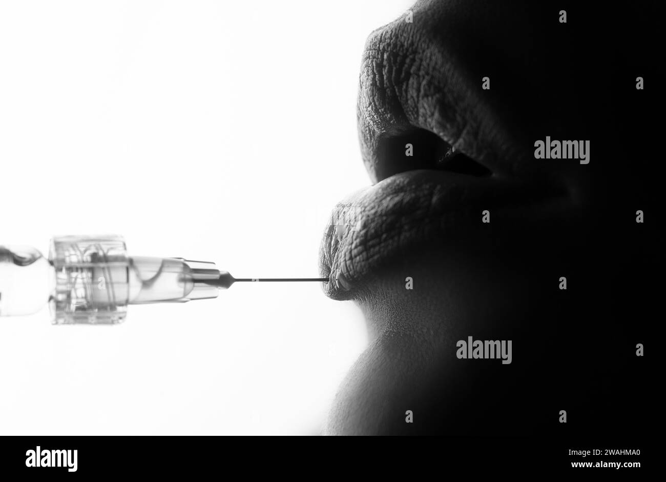 Lips augmentation syringe. Female mouth, hyaluronic acid injection ...