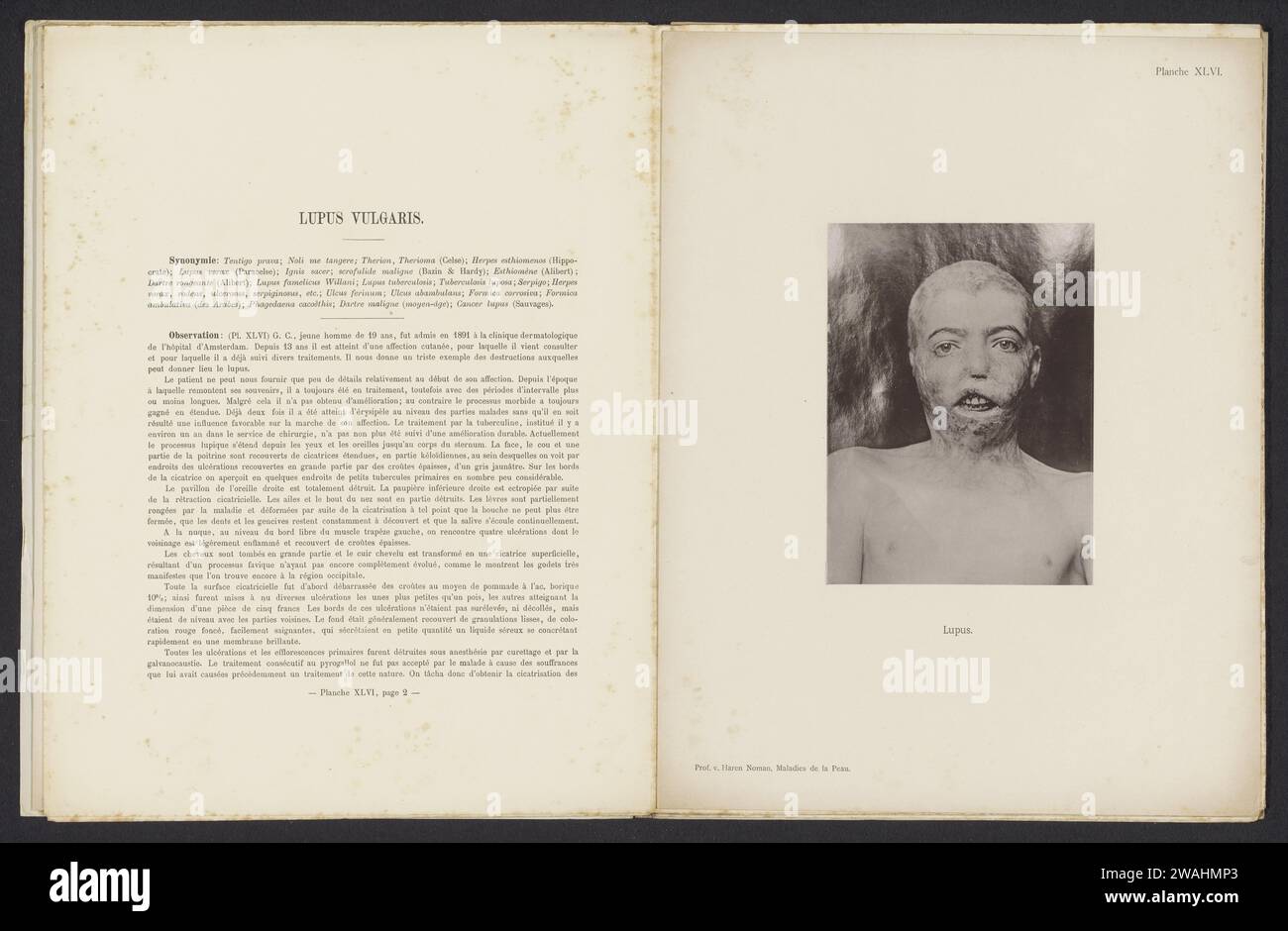 Patient 1887 hi-res stock photography and images - Alamy