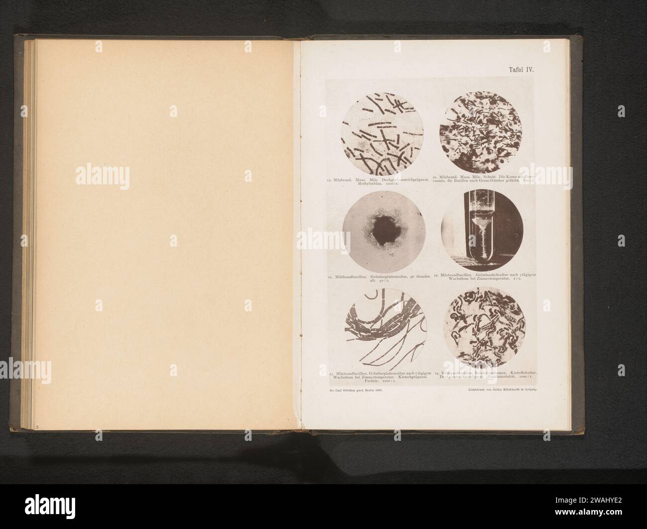 Six microscope recordings of the Spleenvuurbacterie, Carl Günther, c ...