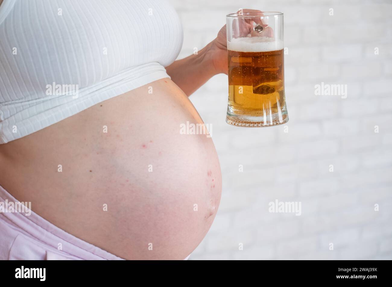 Faceless pregnant woman with rash on stomach holding glass of beer ...