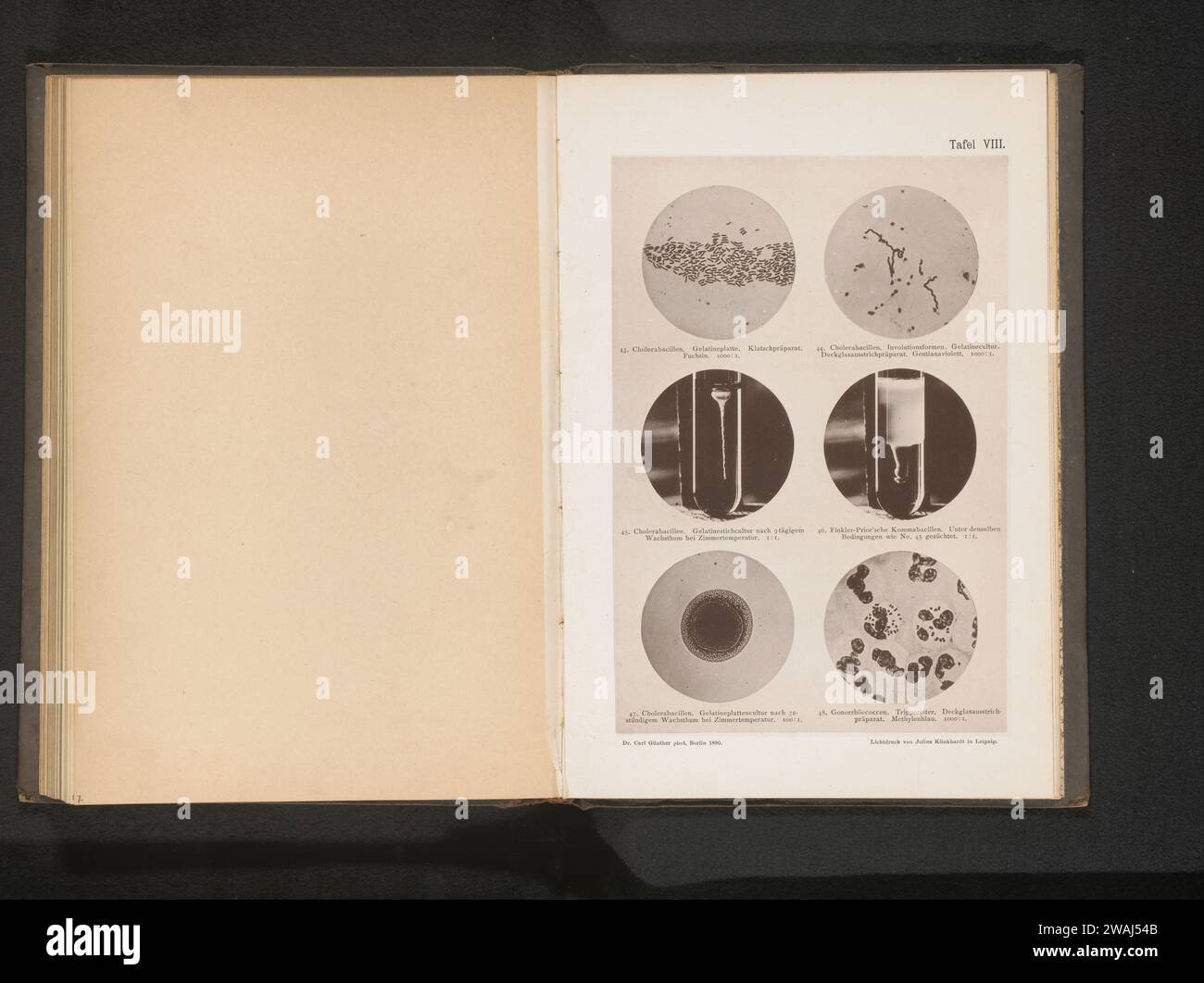 Six microscope recordings of bacteria, including the cholerabacteria ...