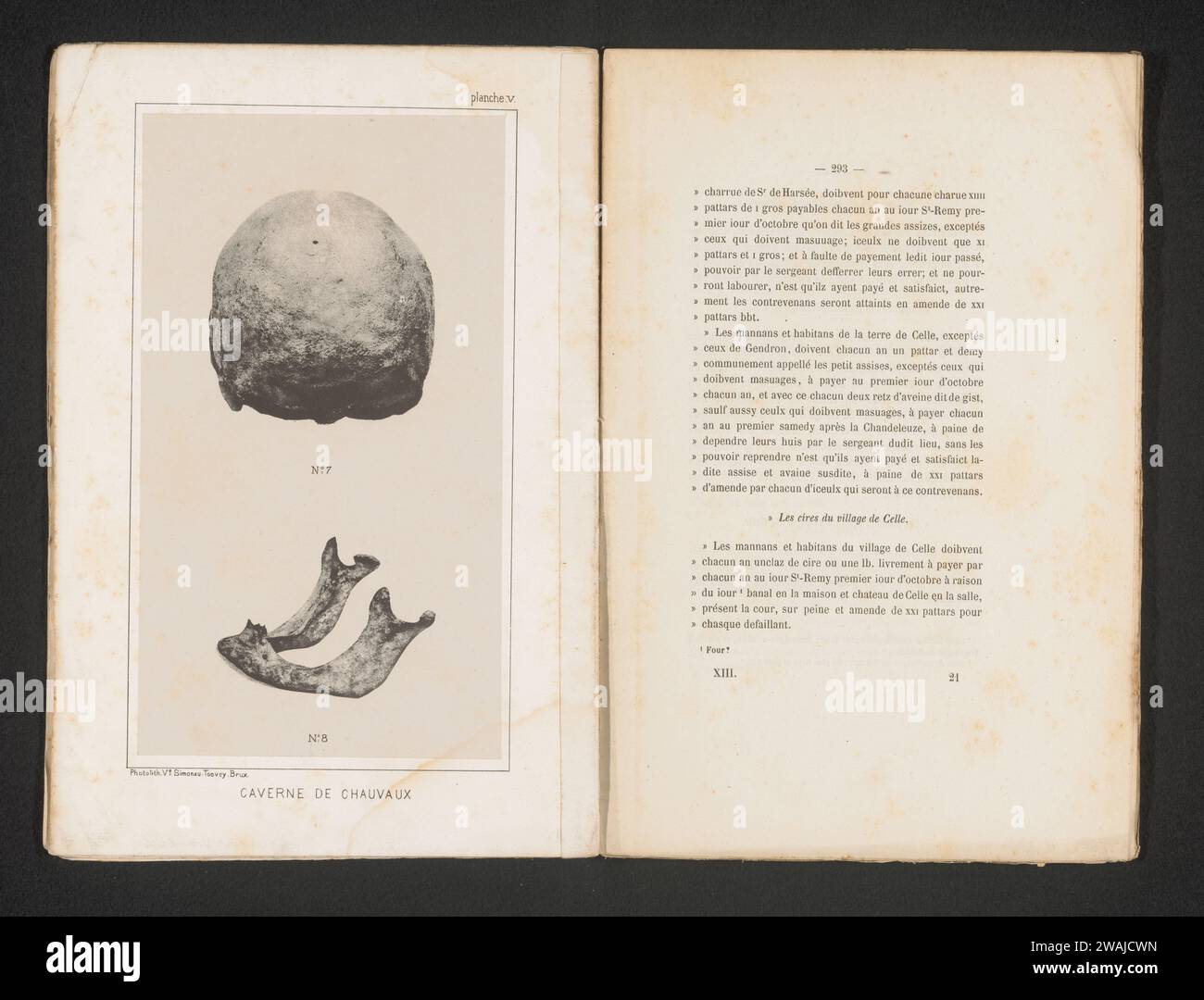 Back view of a skull and face on a lower jaw, Simonau & Tooey, c. 1870 ...