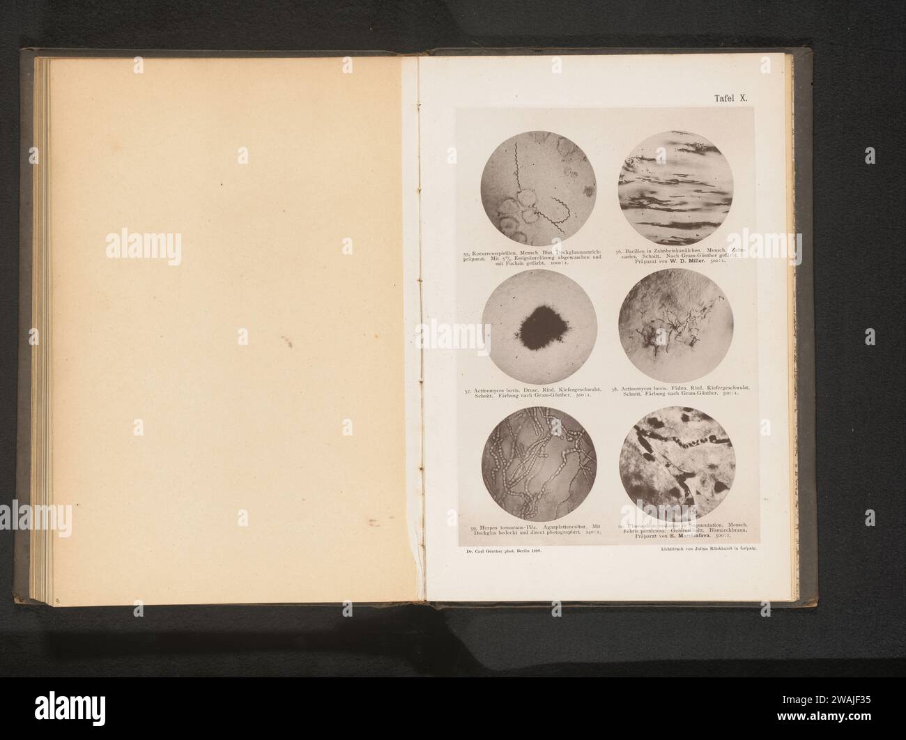 Six microscope recordings of bacteria, Carl Günther, c. 1880 - in or ...