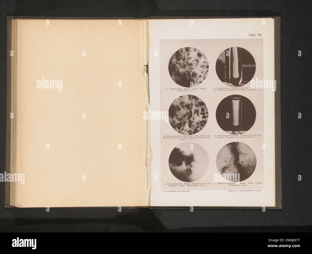 Typhus bacteria hi-res stock photography and images - Alamy