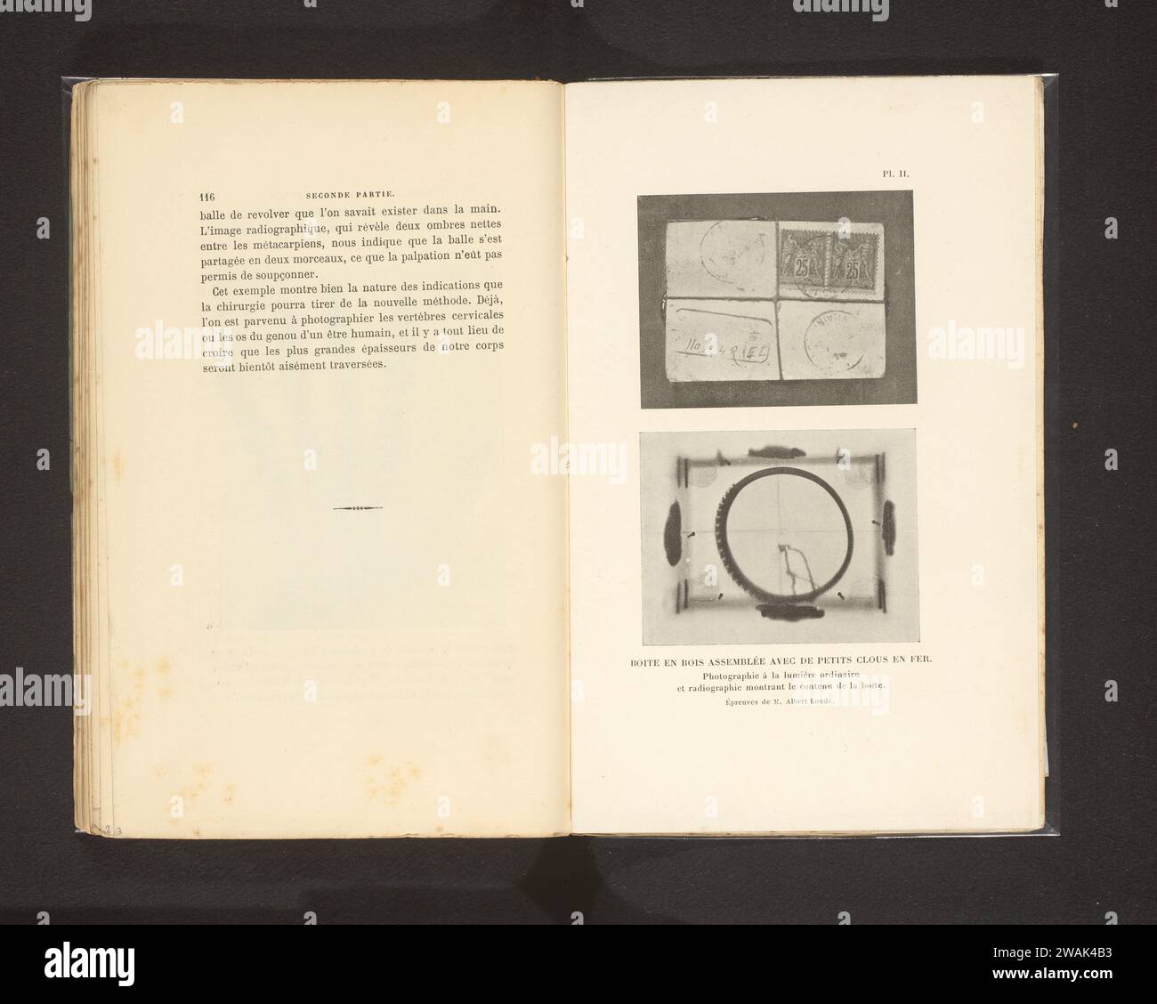 Albert londe hi-res stock photography and images - Alamy