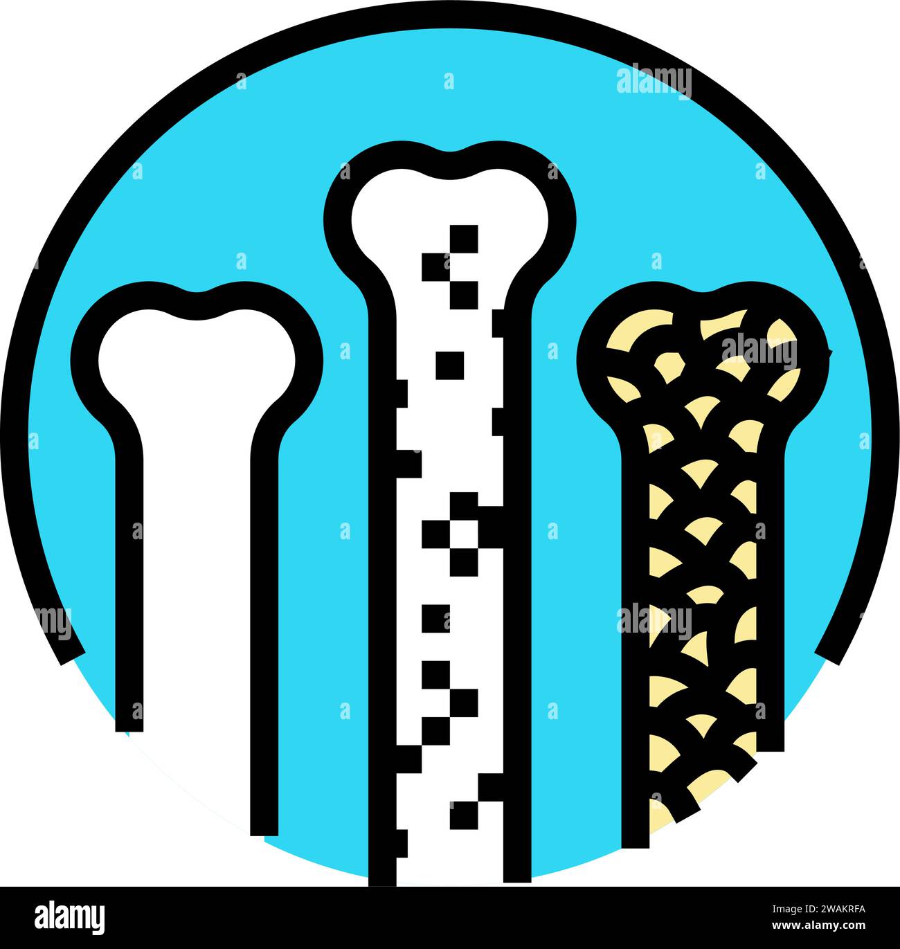 density bone osteoporosis color icon vector illustration Stock Vector ...