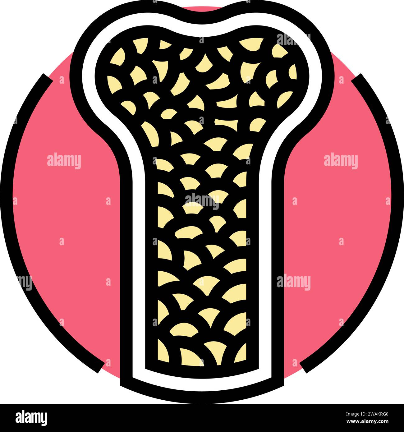 porous bone osteoporosis color icon vector illustration Stock Vector ...