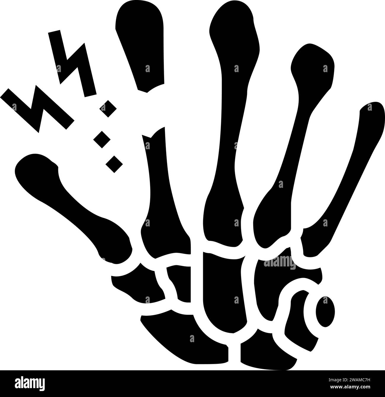 fracture hand bones osteoporosis glyph icon vector illustration Stock ...