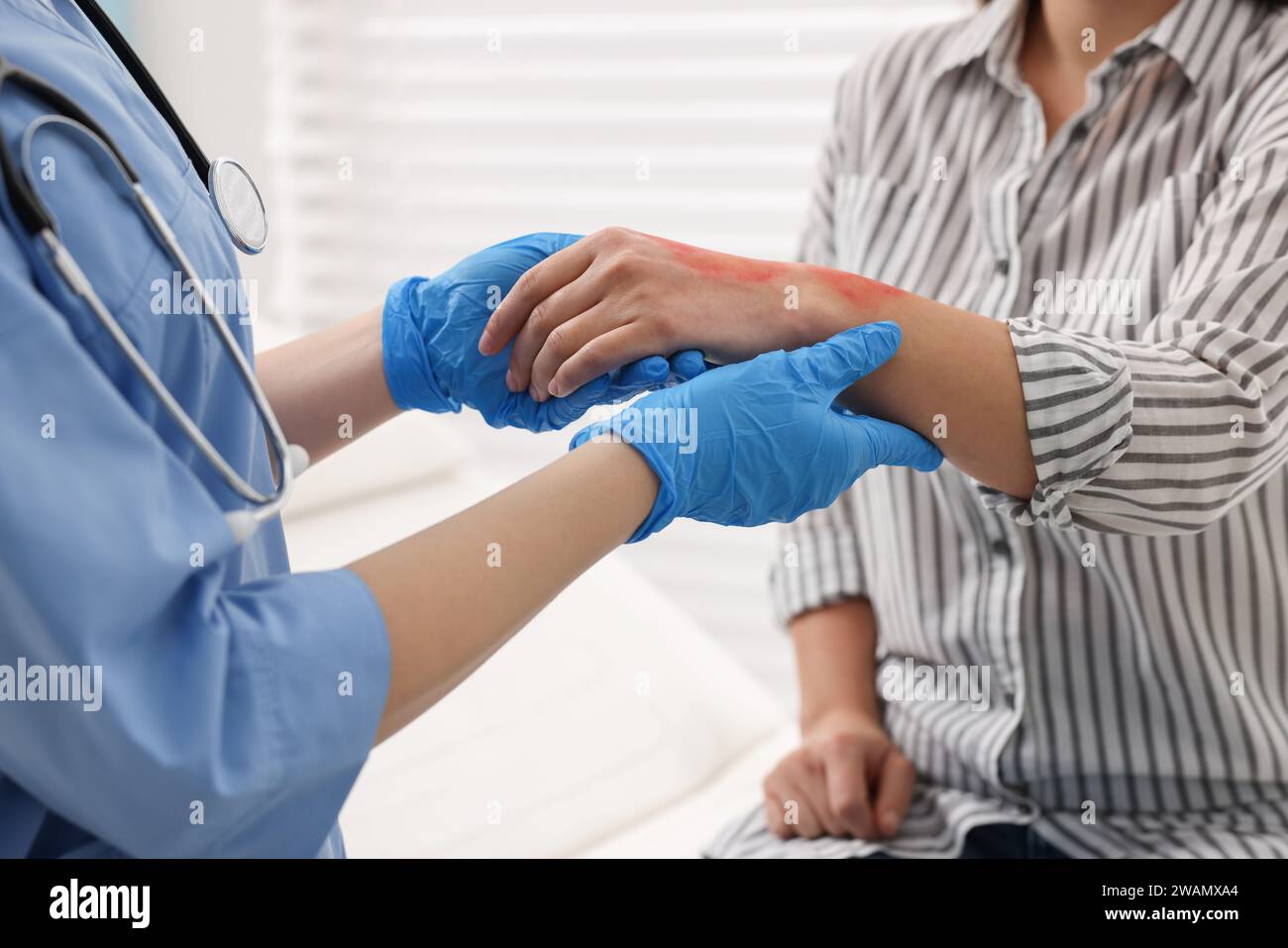 Doctor examining patient's burned hand in hospital, closeup Stock Photo ...
