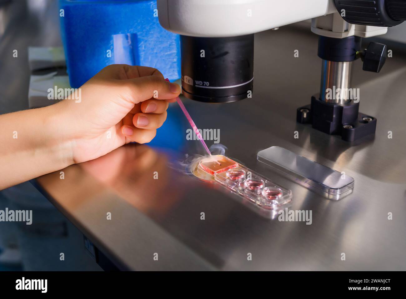 Human sperm microscope hi-res stock photography and images - Alamy