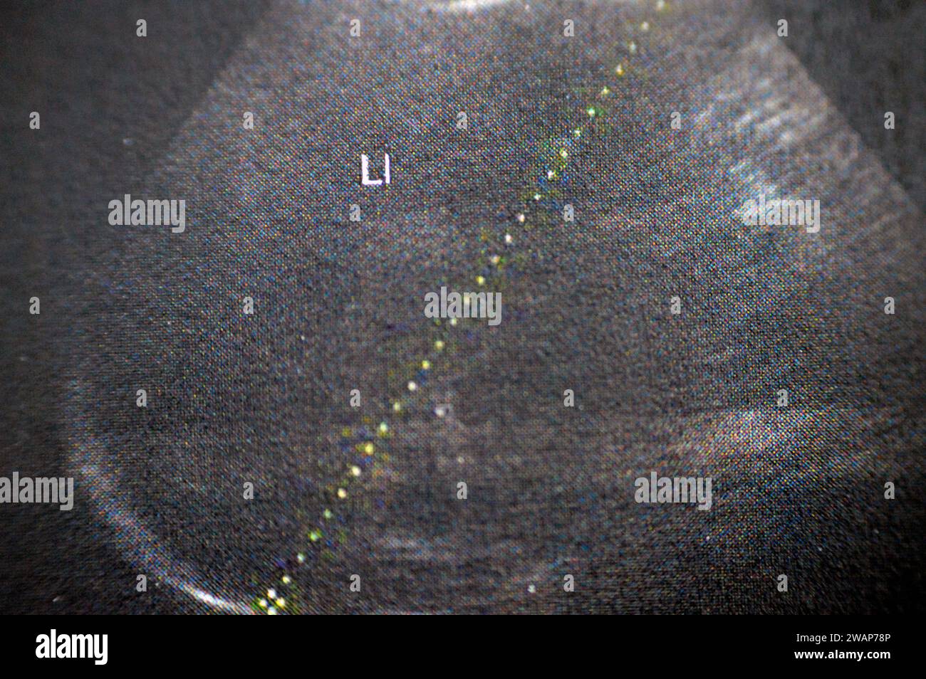 the liver is average in size 15 cm, with homogeneous echogenicity, no ...