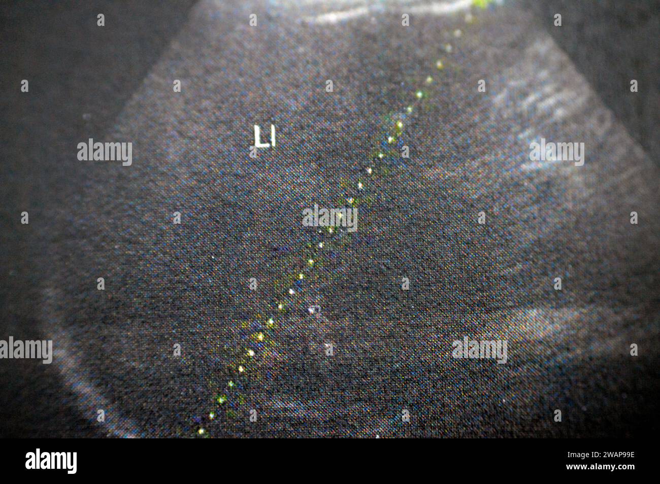 the liver is average in size 15 cm, with homogeneous echogenicity, no ...