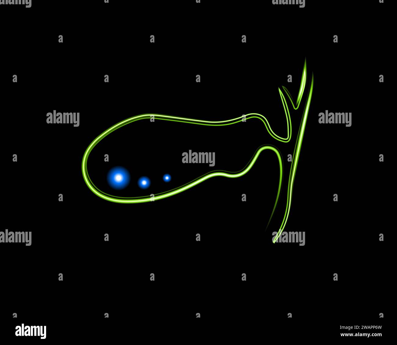Vector isolated illustration of gall bladder with neon effect ...
