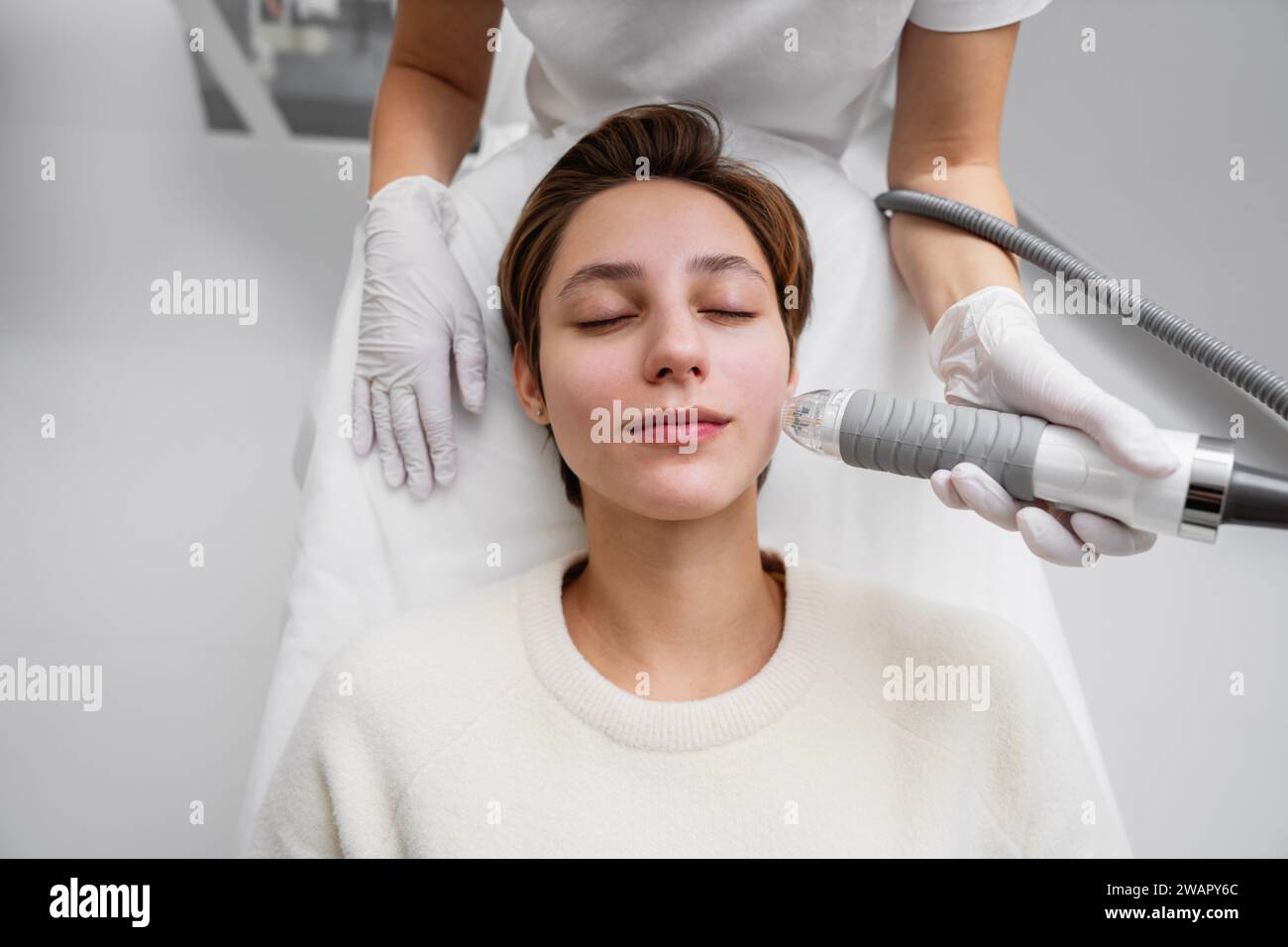 Microneedle RF lifting procedure Stock Photo - Alamy