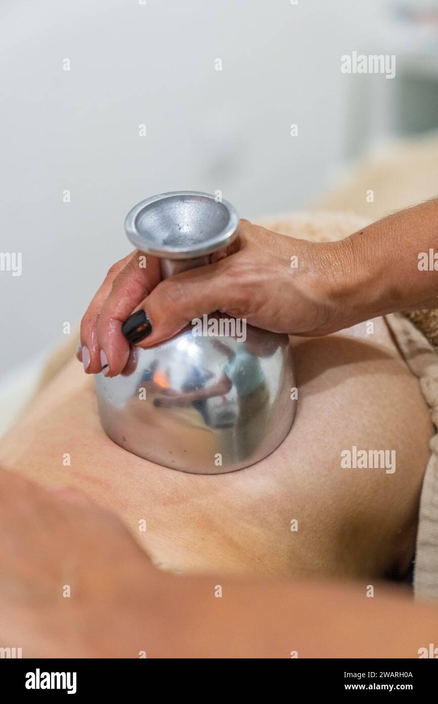 A Masseuse using a metallic Swedish cup for metallotherapy on patient's ...