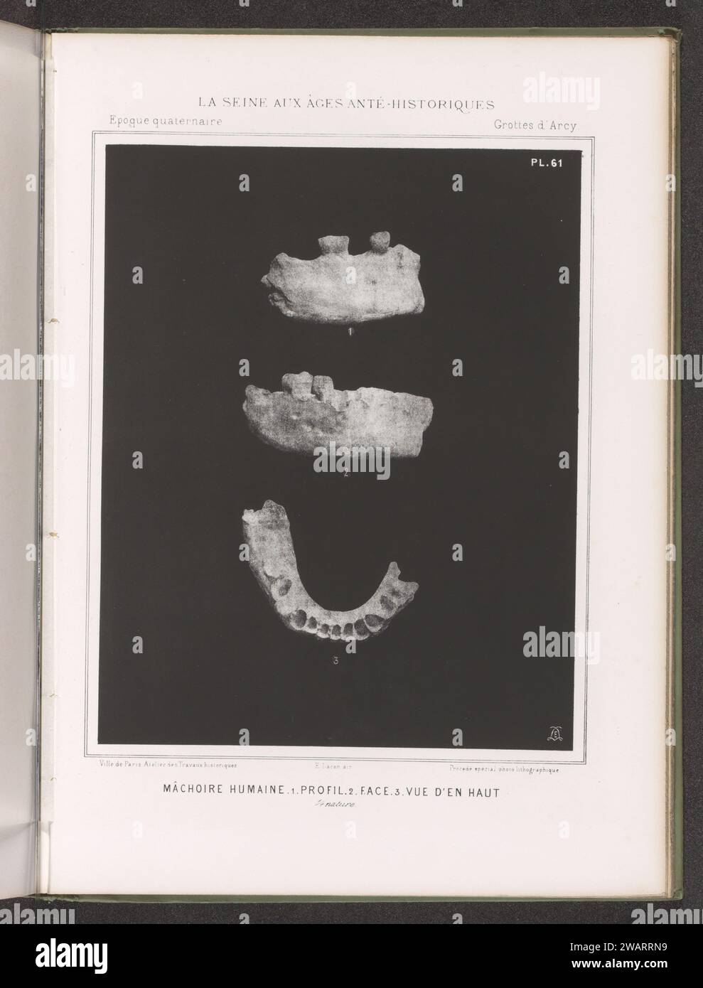 Three views of a human jaw, side view, front view, top view, c. 1860 ...