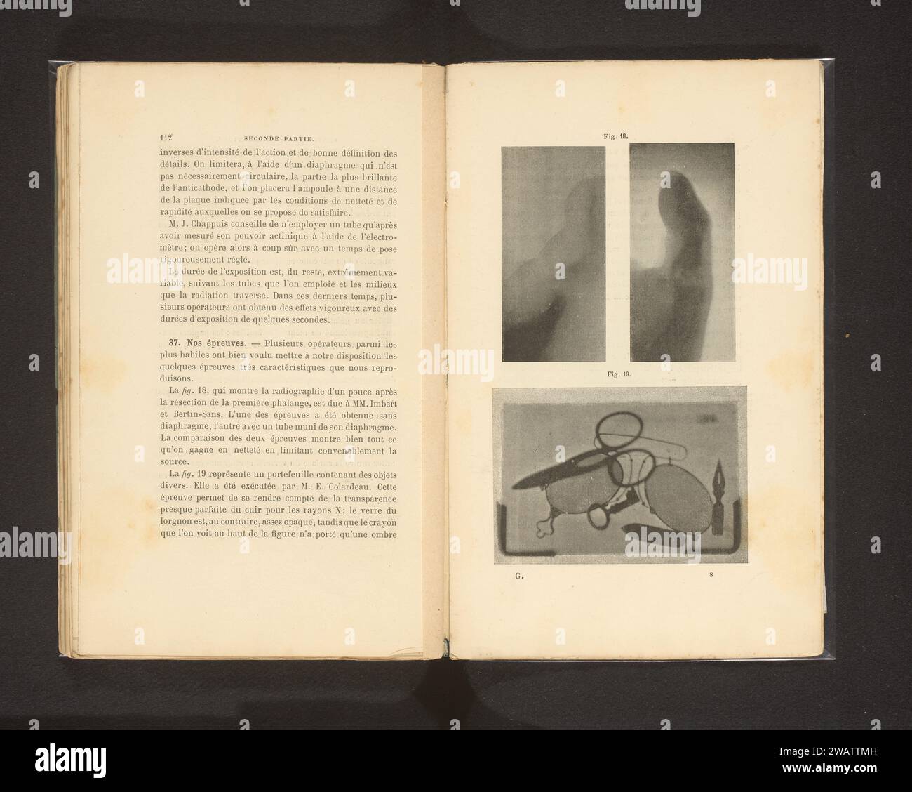 X rays scissors hi-res stock photography and images - Alamy