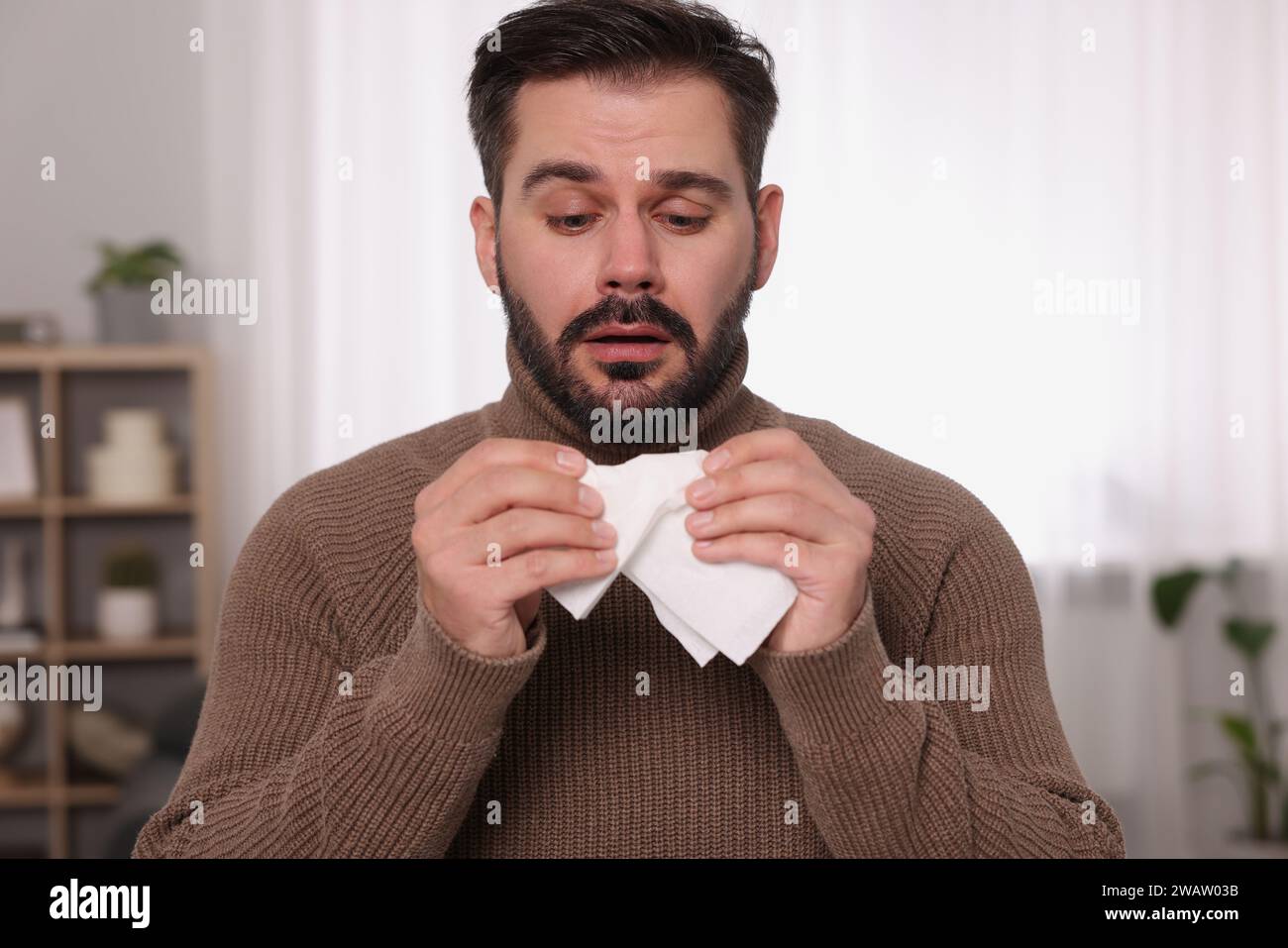 Sick man with tissue at home. Cold symptoms Stock Photo - Alamy