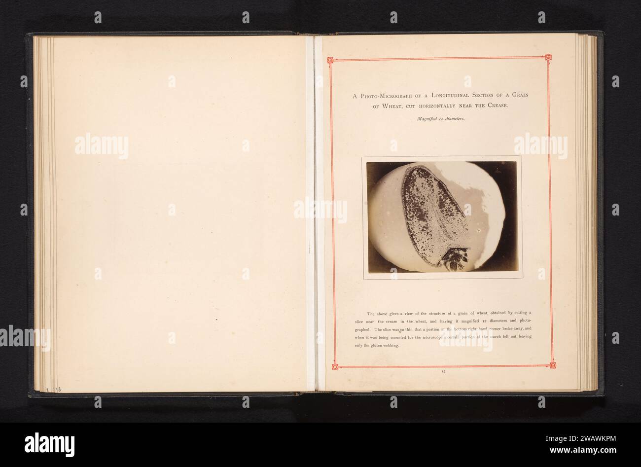 Microscope intake of a wheat grain, Robert W. Dunham, c. 1882 - in or ...