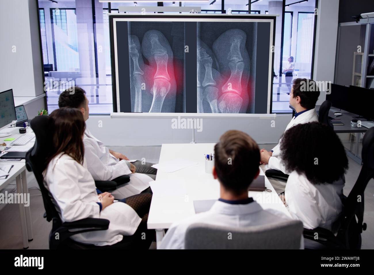 Radiologist Doctor Group Conference With Feet Xray Stock Photo - Alamy