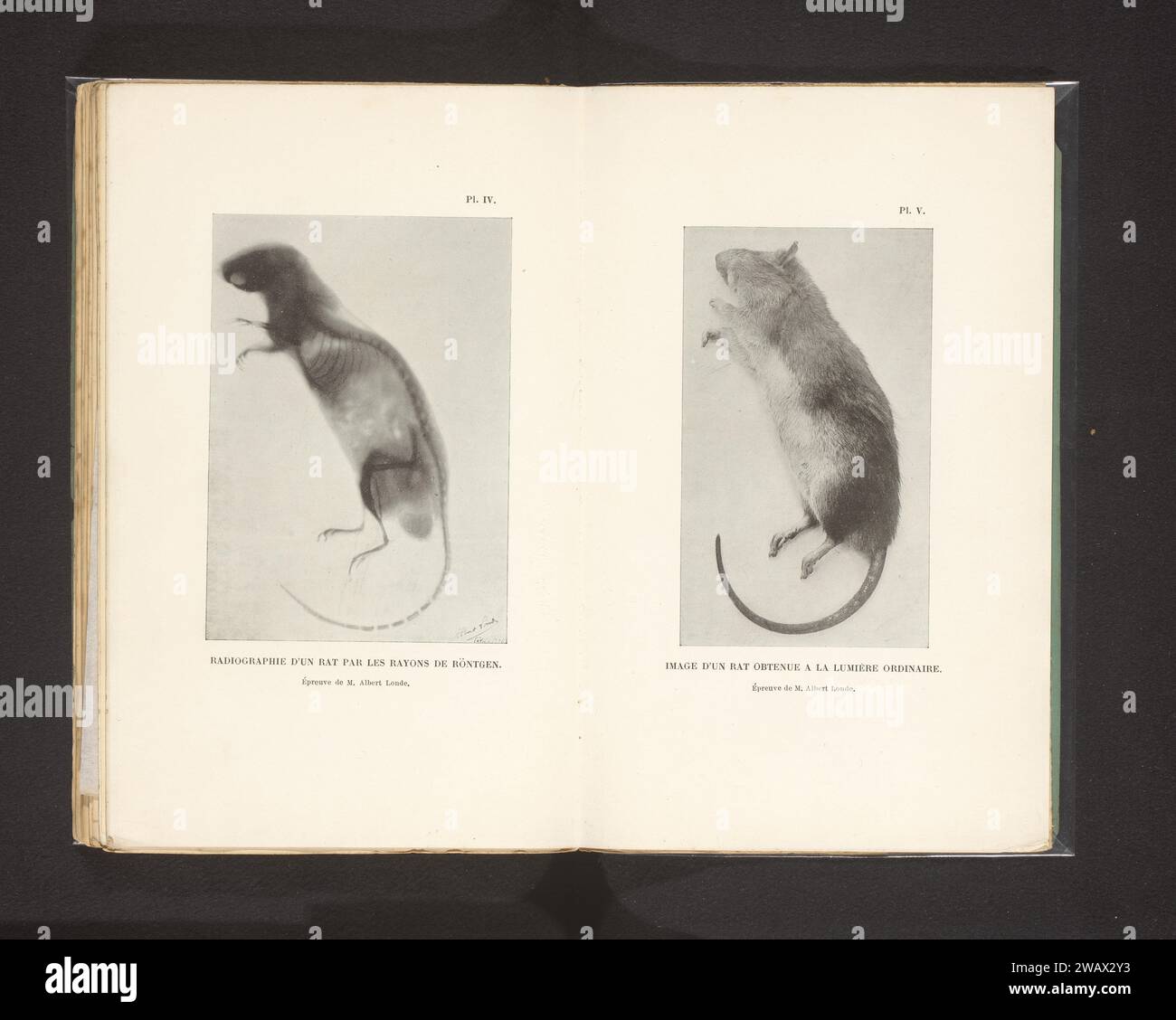 Albert londe hi-res stock photography and images - Alamy