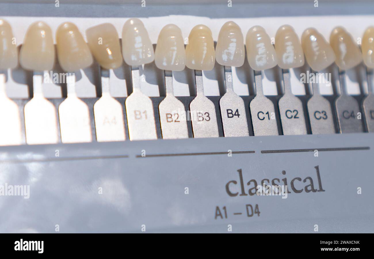 Samples of teeth of various shapes and colors Stock Photo - Alamy