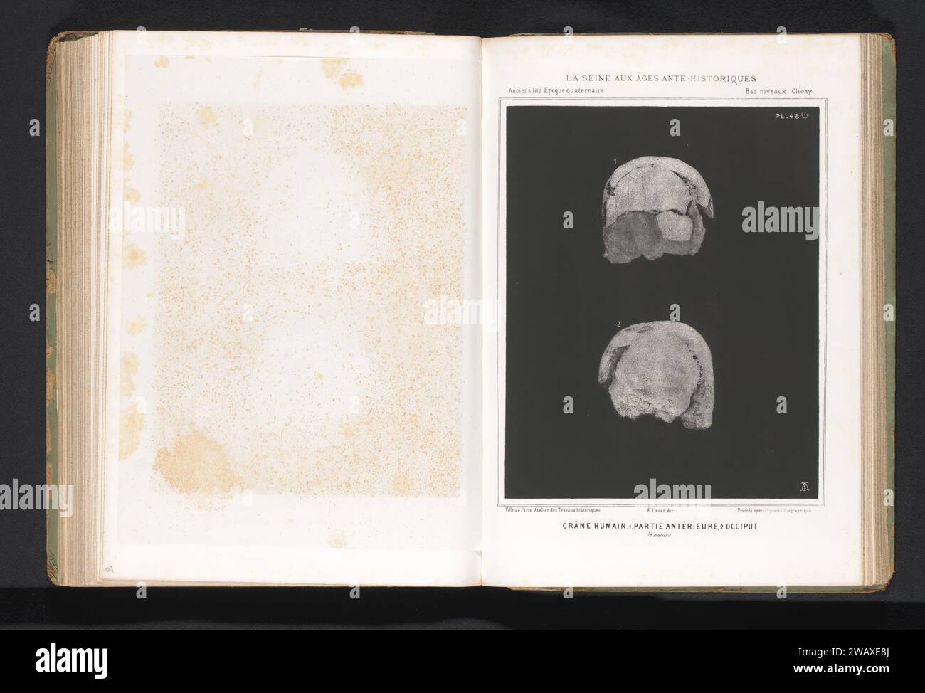 Two views of a human skull, front view and rear view, Ville de Paris ...
