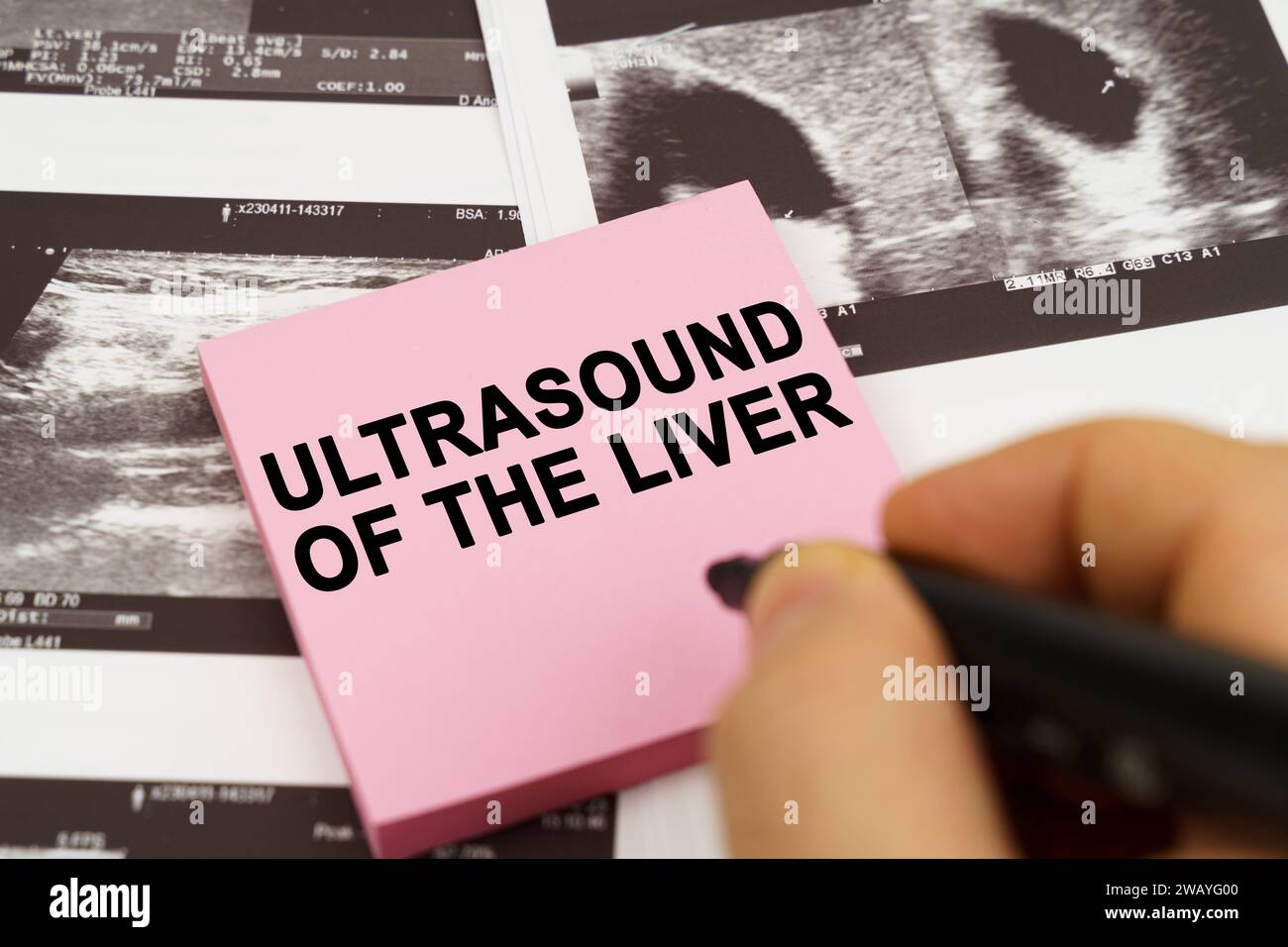 Medical concept. On the ultrasound pictures there are stickers that say ...