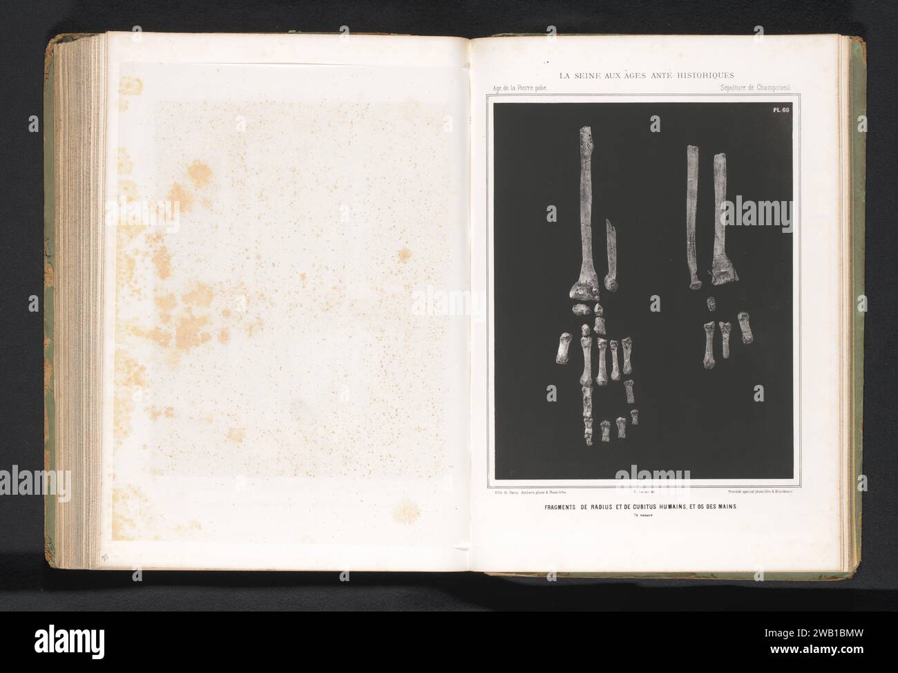 Skeletal fragments hi-res stock photography and images - Alamy