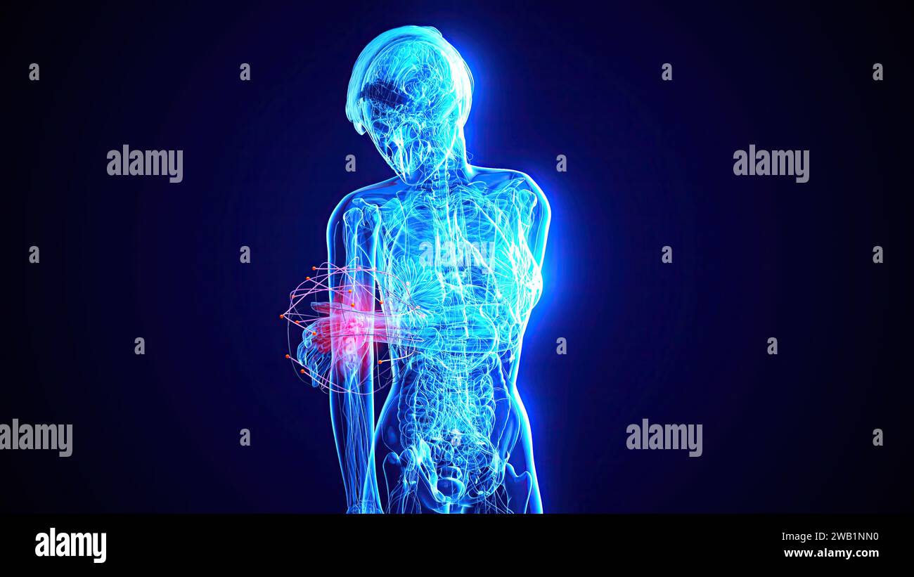 Anatomy concept of an elbow pain Stock Photo - Alamy