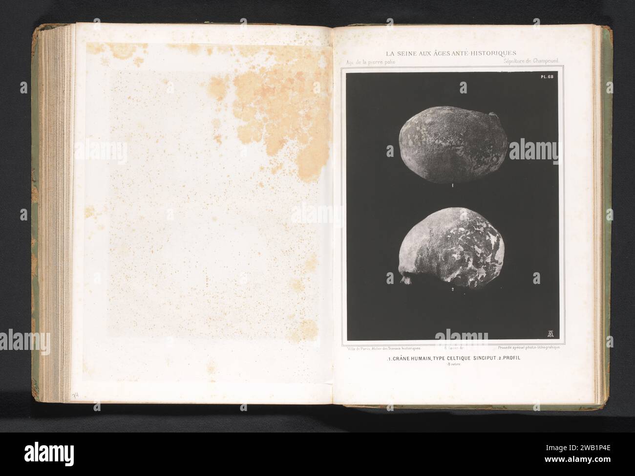 Two views of a human skull, Ville de Paris (Possible), c. 1864 - in or ...
