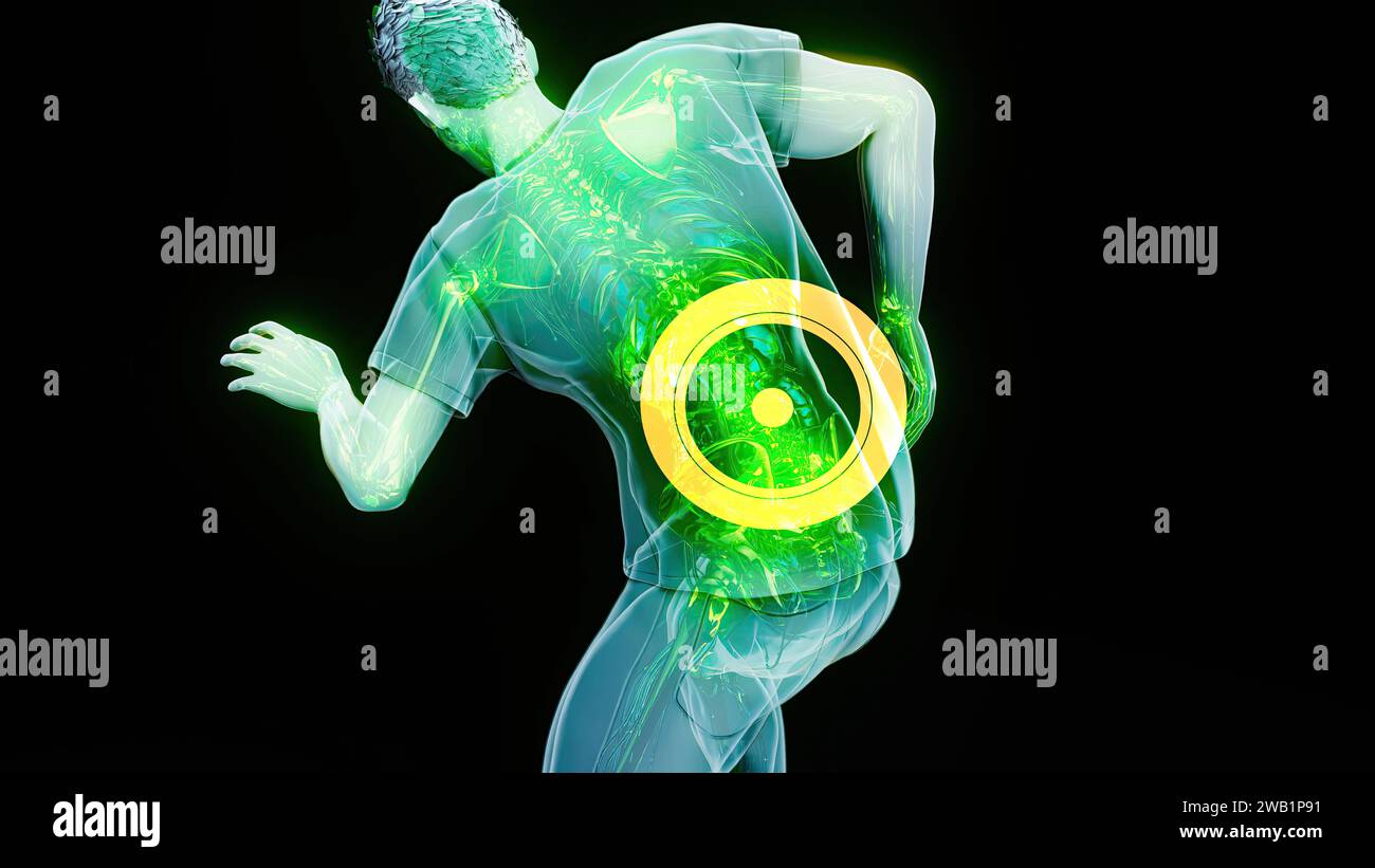Backpain illustration hi-res stock photography and images - Alamy