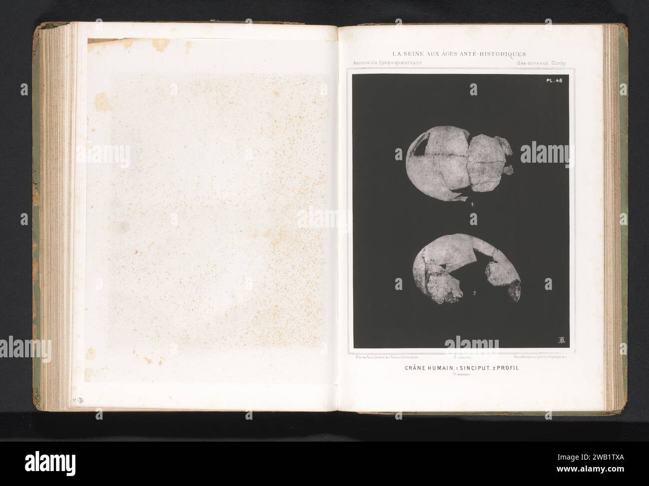Two views of a human skull, top view and and profil, Ville de Paris ...