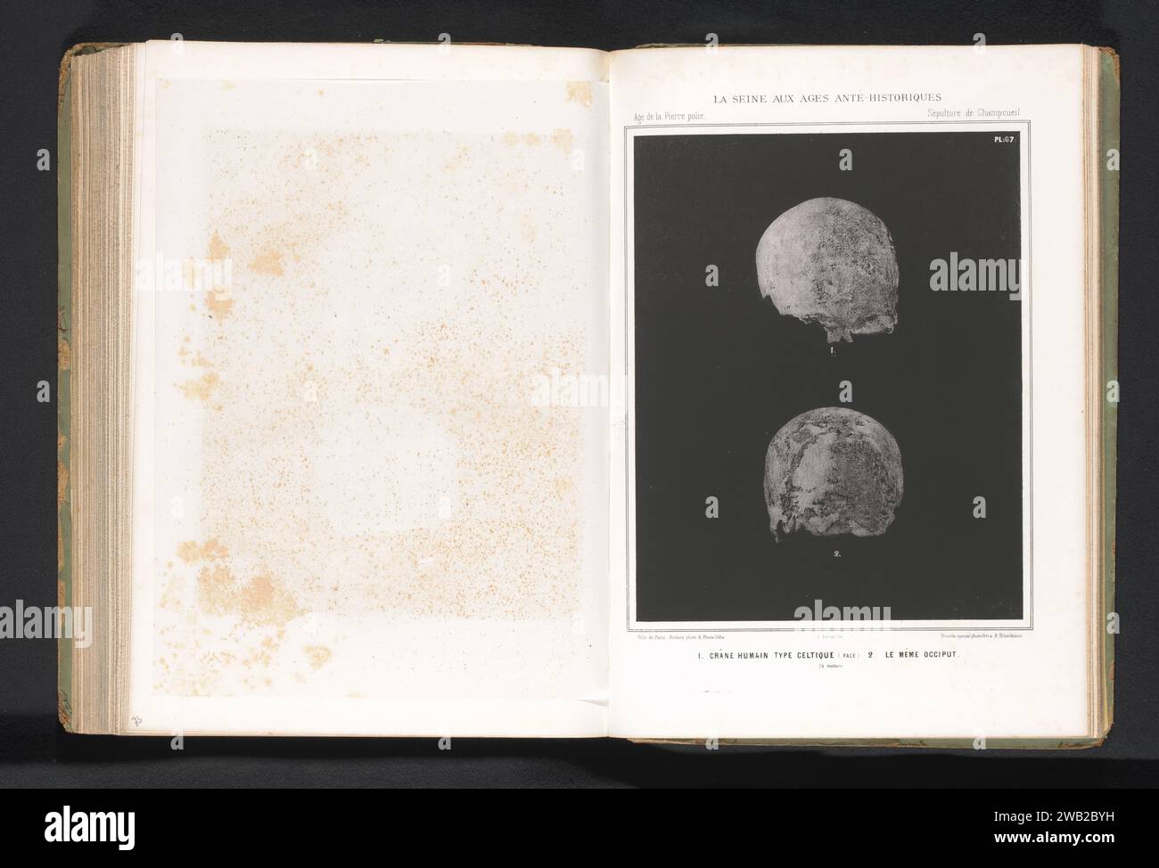 Two views of a human skull, Ville de Paris, c. 1864 - in or before 1869 ...